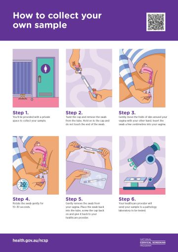 National Cervical Screening Program – How to collect your own sample ...